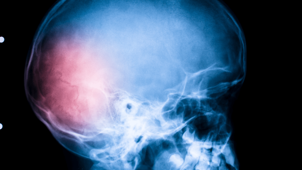 Medical Trauma - What is it and How is it Treated? - Theatre Ghost